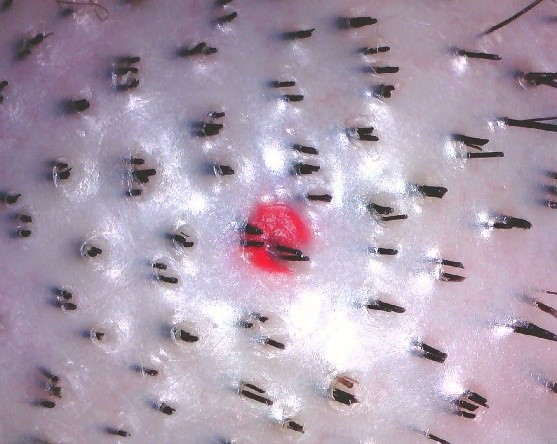 더케이피부과학연구소